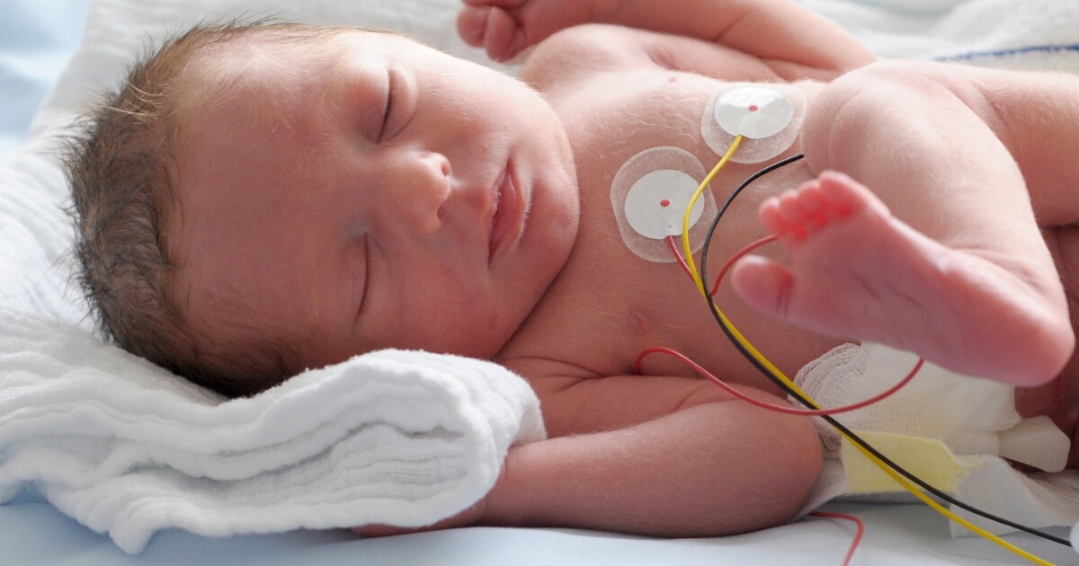 Ecg neonatale: cos'è e cosa significano i valori - CLINICA VIANA